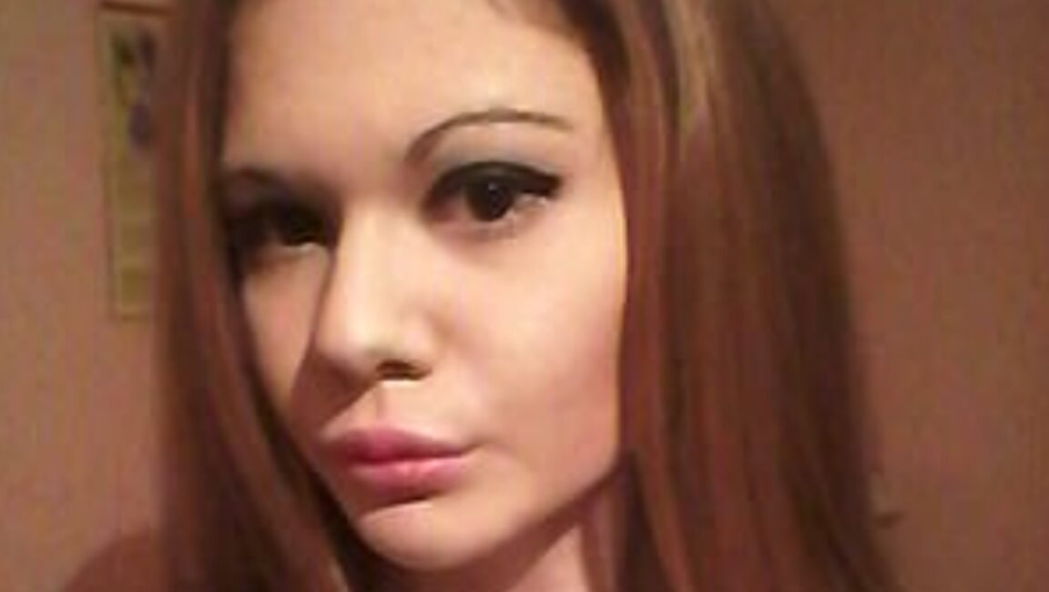 Barbie umana, la donna con le labbra più grandi del mondo: dopo 20 ...